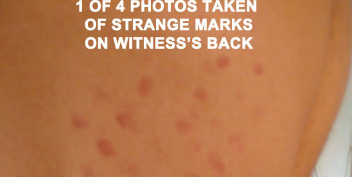 Woman Finds Strange Marks on Back After a Paranormal Experience - The ...